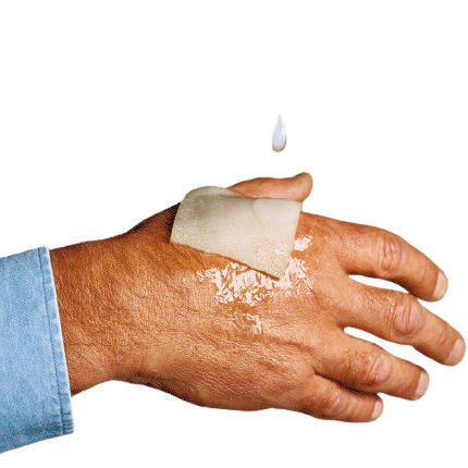 Sterile burn dressing - 94371 - AKLA