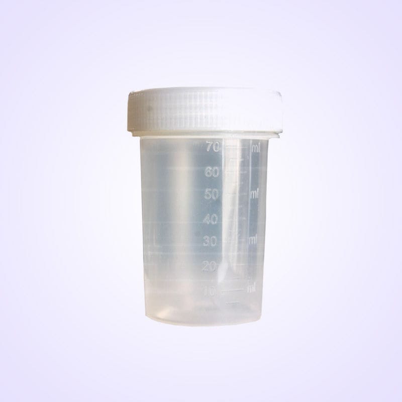 Urology sample container - UR-06 - Angiplast - urine / with screw cap ...