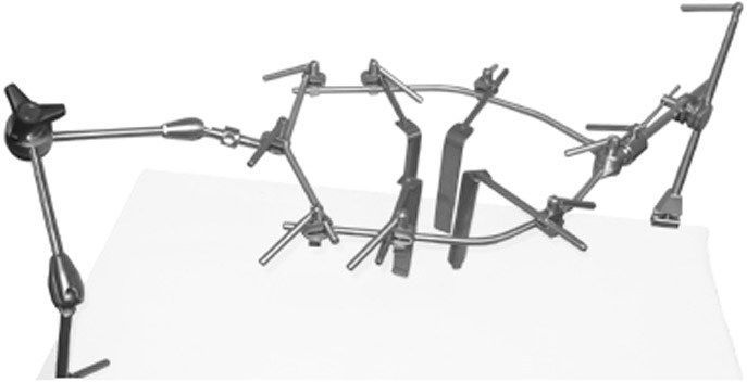 Spinal retractor - 9060 - Ansabere Surgical - surgical