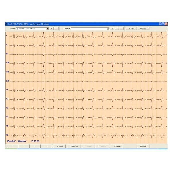Viewer software - CARDIOTEKA v.211SOFTHL7 - ASPEL - electrocardiography ...