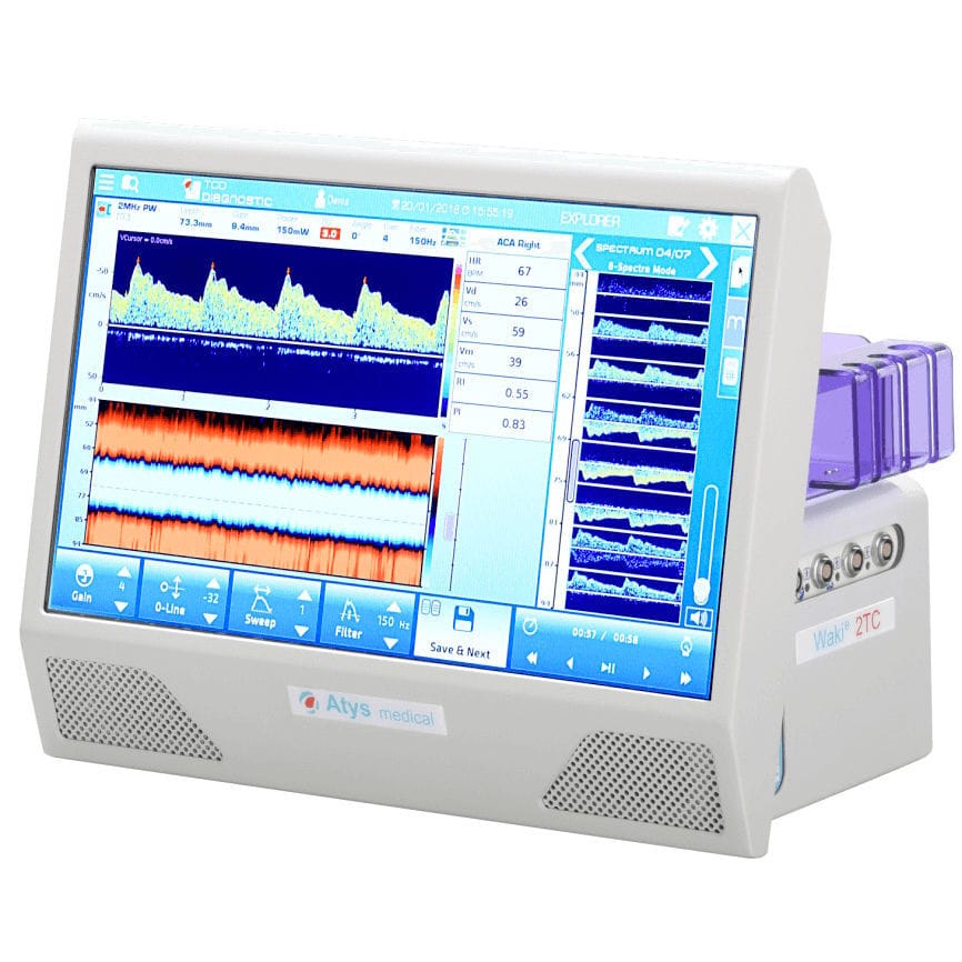 Transcranial doppler - WAKIe - ATYS Medical - table / with HITS ...