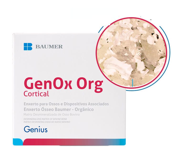 Xenograft bone substitute - GenOx Org - BAUMER - for dental sugery ...