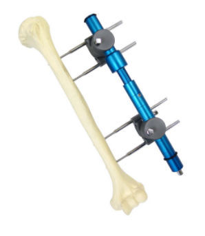 Humerus external fixation system - 563.10 - BAUMER - tubular / adult