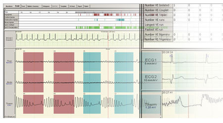 Diagnostic software - Compumedics - monitoring / polysomnography