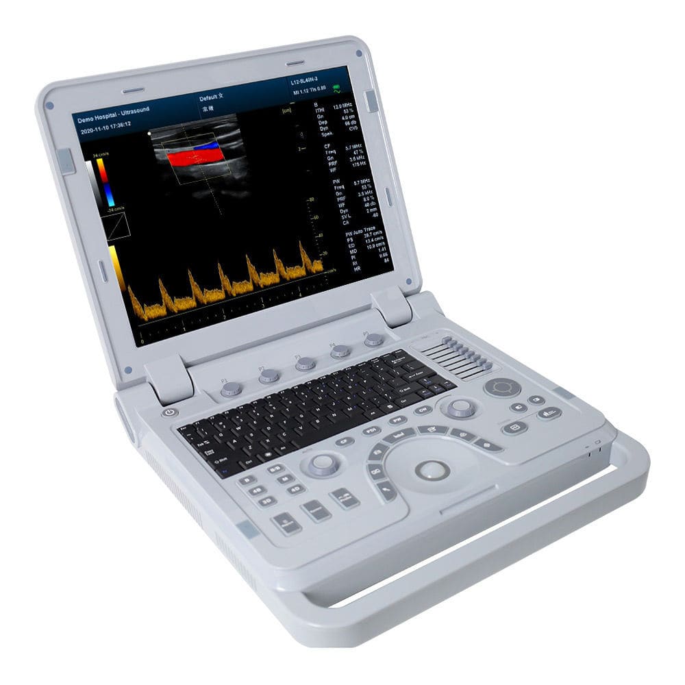 Portable ultrasound system - CMS1700B - Contec Medical Systems - for ...
