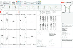 Diagnostic algorithm - ECG algorithms - Corscience GmbH & Co. KG ...