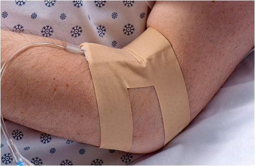 IV catheter band - IV-ARMOR® - Dale Medical Products - arm / adhesive