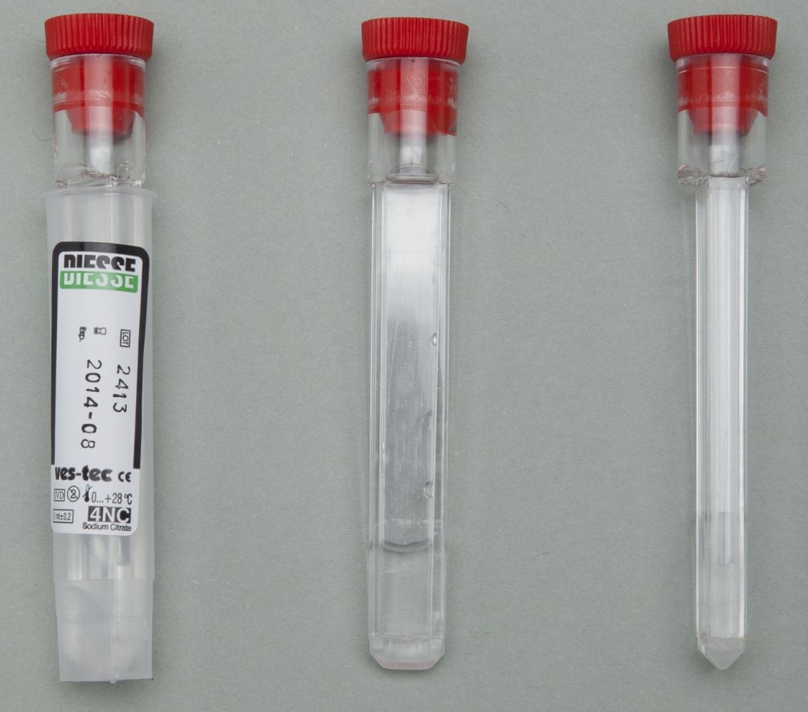 Laboratory test tube - VES-TEC - Diesse Diagnostica Senese - ESR ...