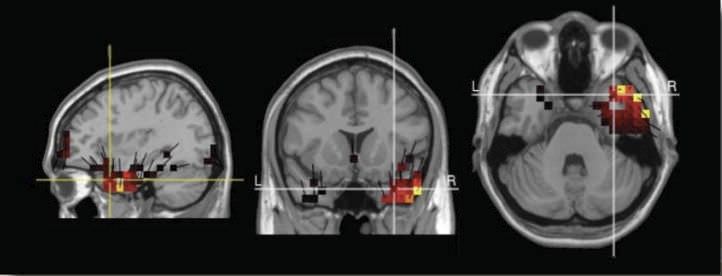 Visualization software - GeoSource 2.0 - Electrical Geodesics - medical ...
