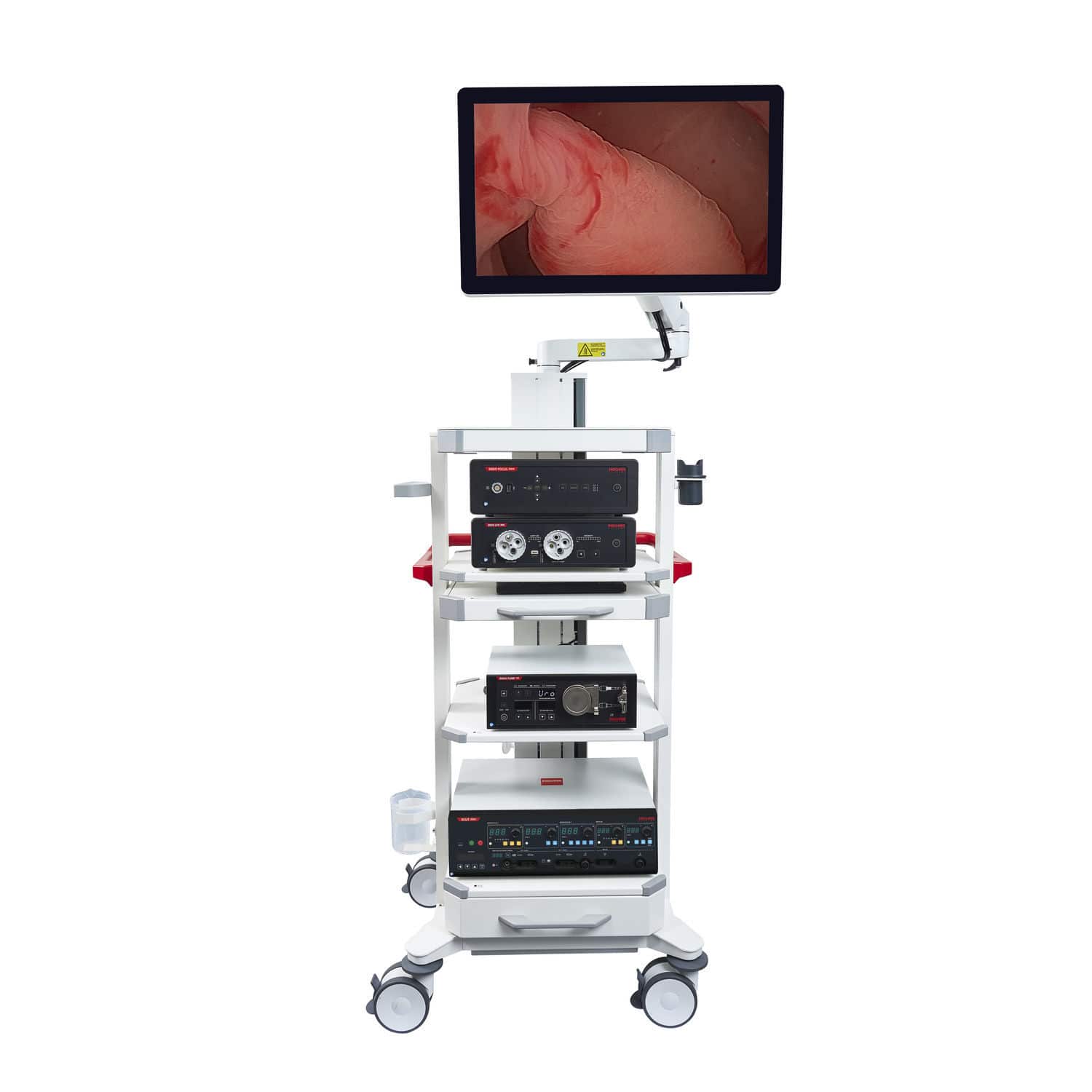 Gynecological endoscopy column - Economy - EndoMed Systems