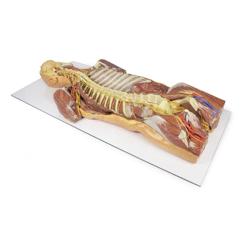 Thorax model - MP1410 - Erler-Zimmer - for teaching