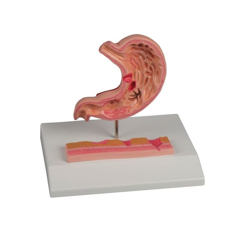 Stomach model - K217 - Erler-Zimmer - duodenum / esophagus