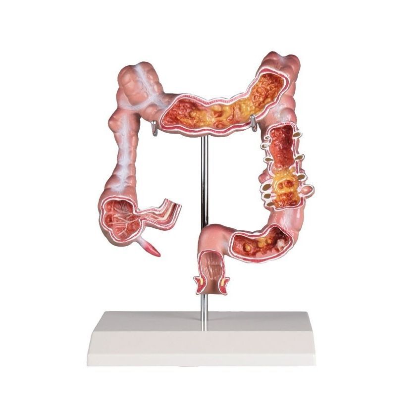 Colon model - K285 - Erler-Zimmer - for teaching