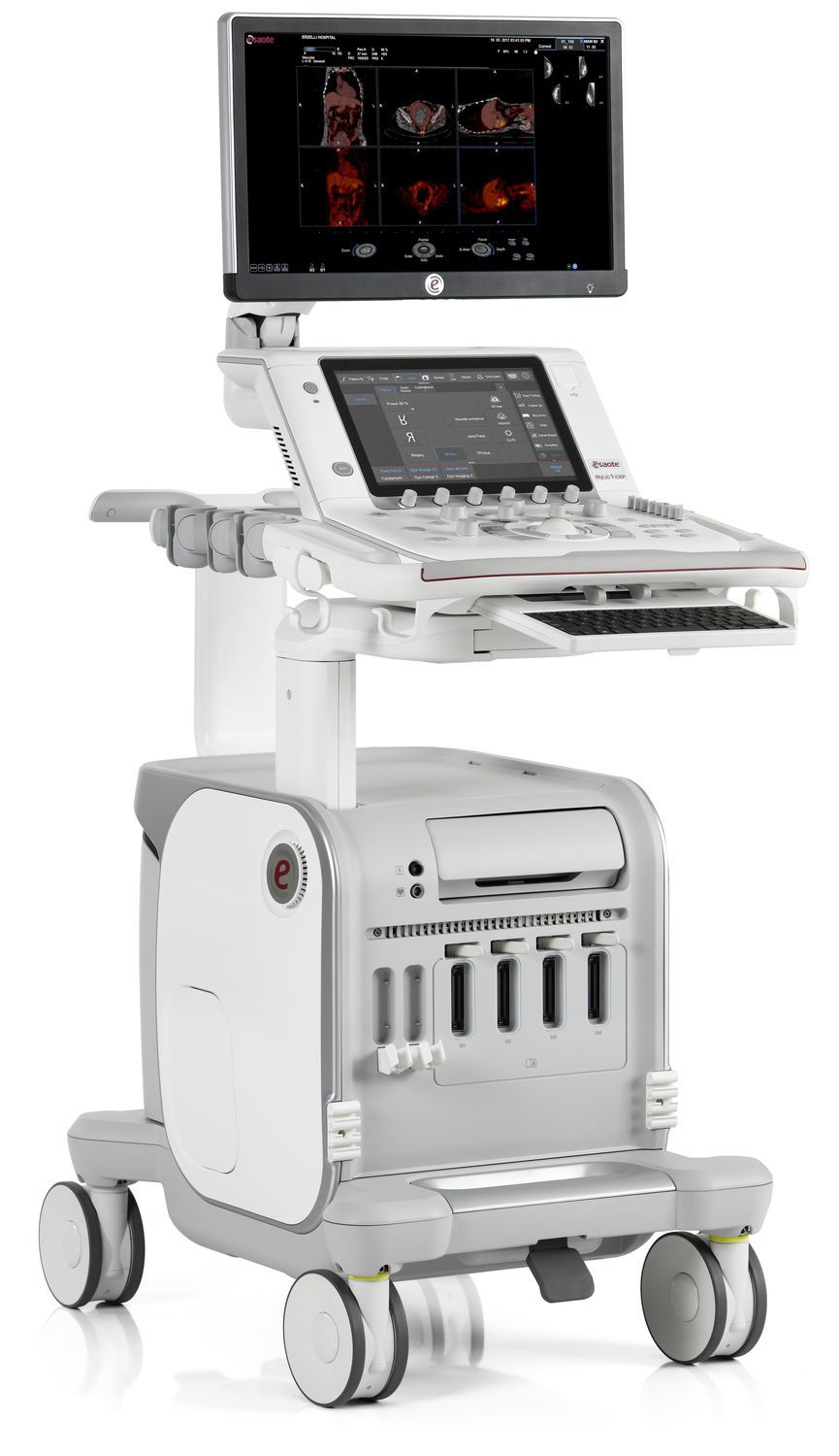 On-platform ultrasound system / for multipurpose ultrasound imaging / B ...