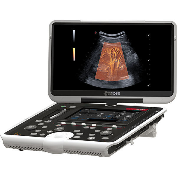 Portable ultrasound system - MyLab™Omega eXP - Esaote - for ...