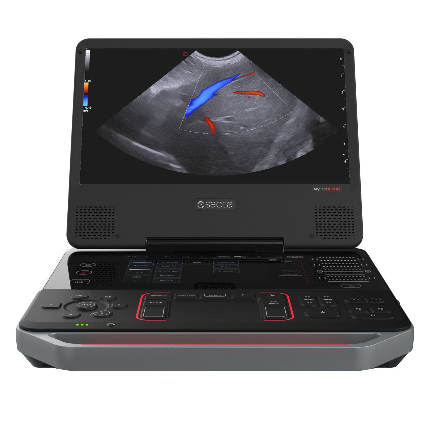 Portable veterinary ultrasound system - MyLab™Heron - Esaote ...