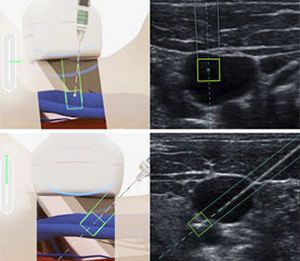 Control software - eZGuide® - eZono - visualization / navigation / medical