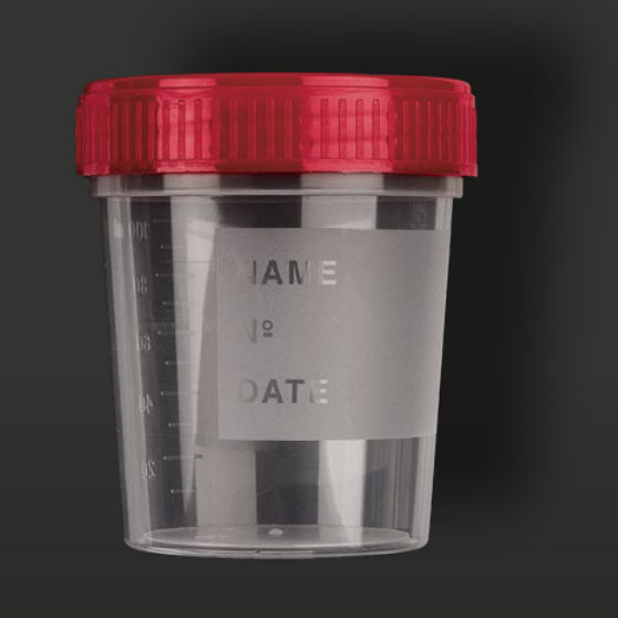 Urine sample container - 250 series - F.L. Medical - polypropylene ...