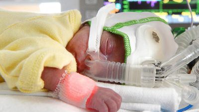 Resuscitation ventilator - EasyFlow - Fritz Stephan - infant / CPAP