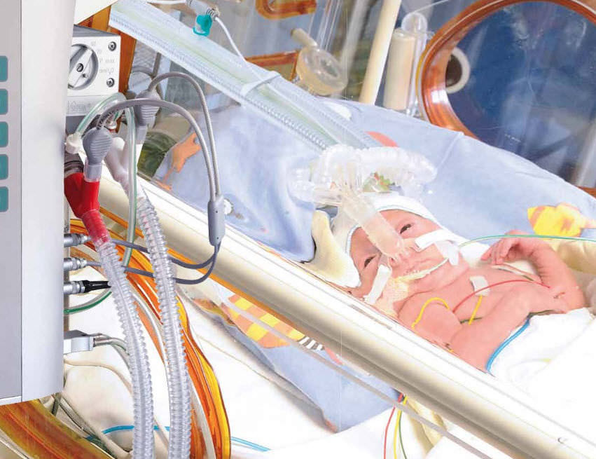 Pediatric breathing circuit - P1 - Fritz Stephan - semi-open / disposable Pediatric breathing circuit - P1 - Fritz Stephan - semi-open / disposable