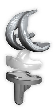 Fixed-bearing knee prosthesis - FHK® - FH Orthopedics