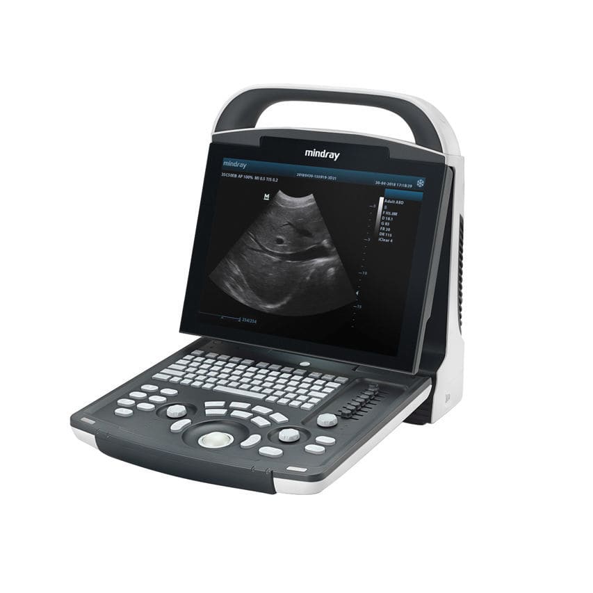 Portable ultrasound system - DP-10 - GIMA - for multipurpose ultrasound ...