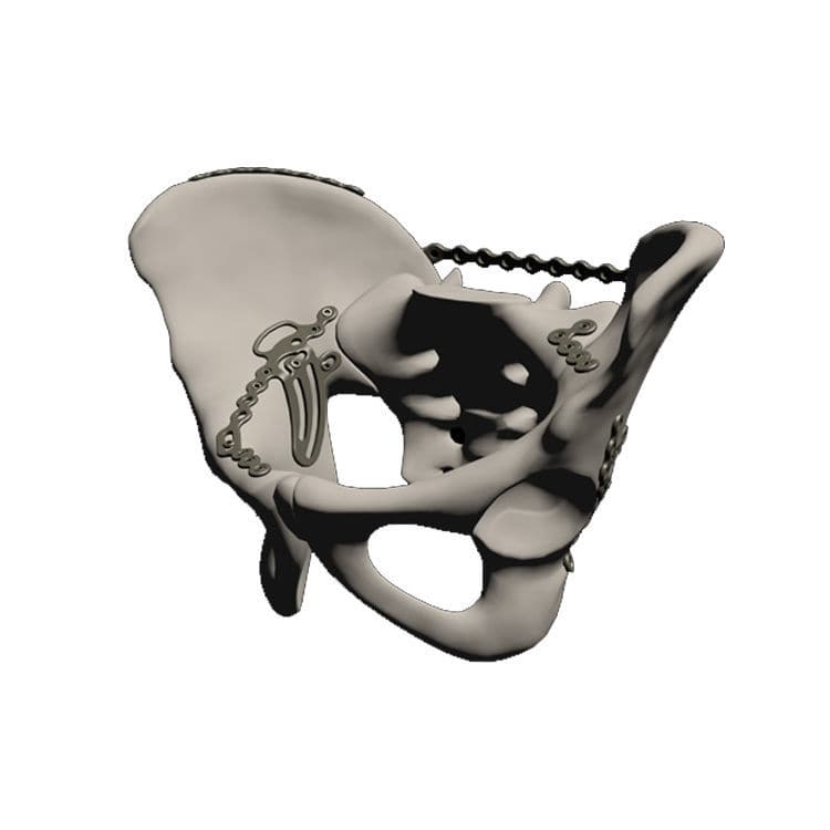 Acetabulum compression plate - PRSPHX - I.T.S. - pelvis / locking ...