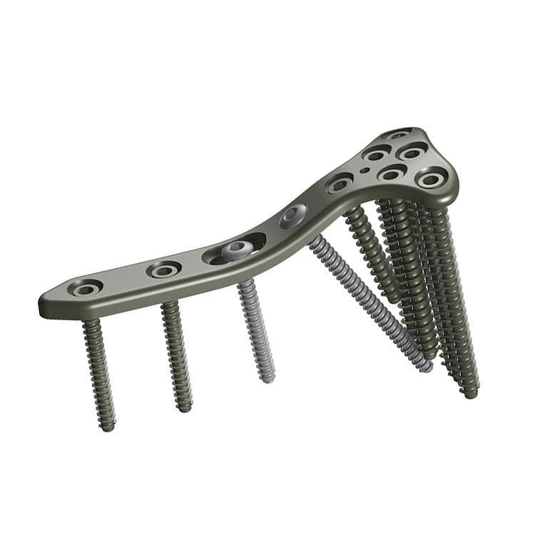 Tibia compression plate - PROMET - I.T.S. - proximal / medial / locking