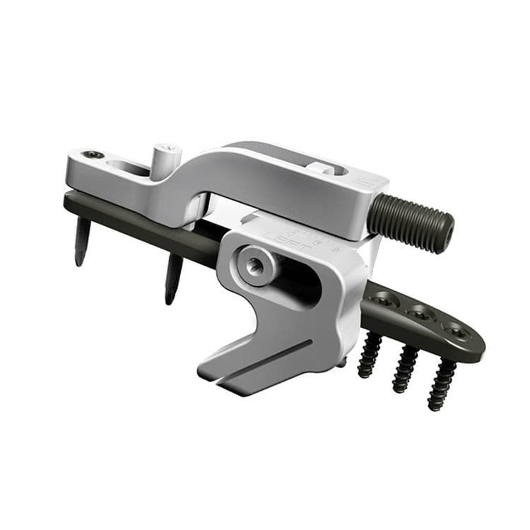 Ulna osteotomy plate - UOL 2 - I.T.S. - distal / locking / metallic