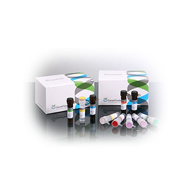 Infectious disease test kit - GeneFinder™ - OSANG Healthcare - for ...
