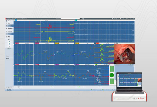 Control software - NEX2019 - inomed Medizintechnik - monitoring / measurement / security