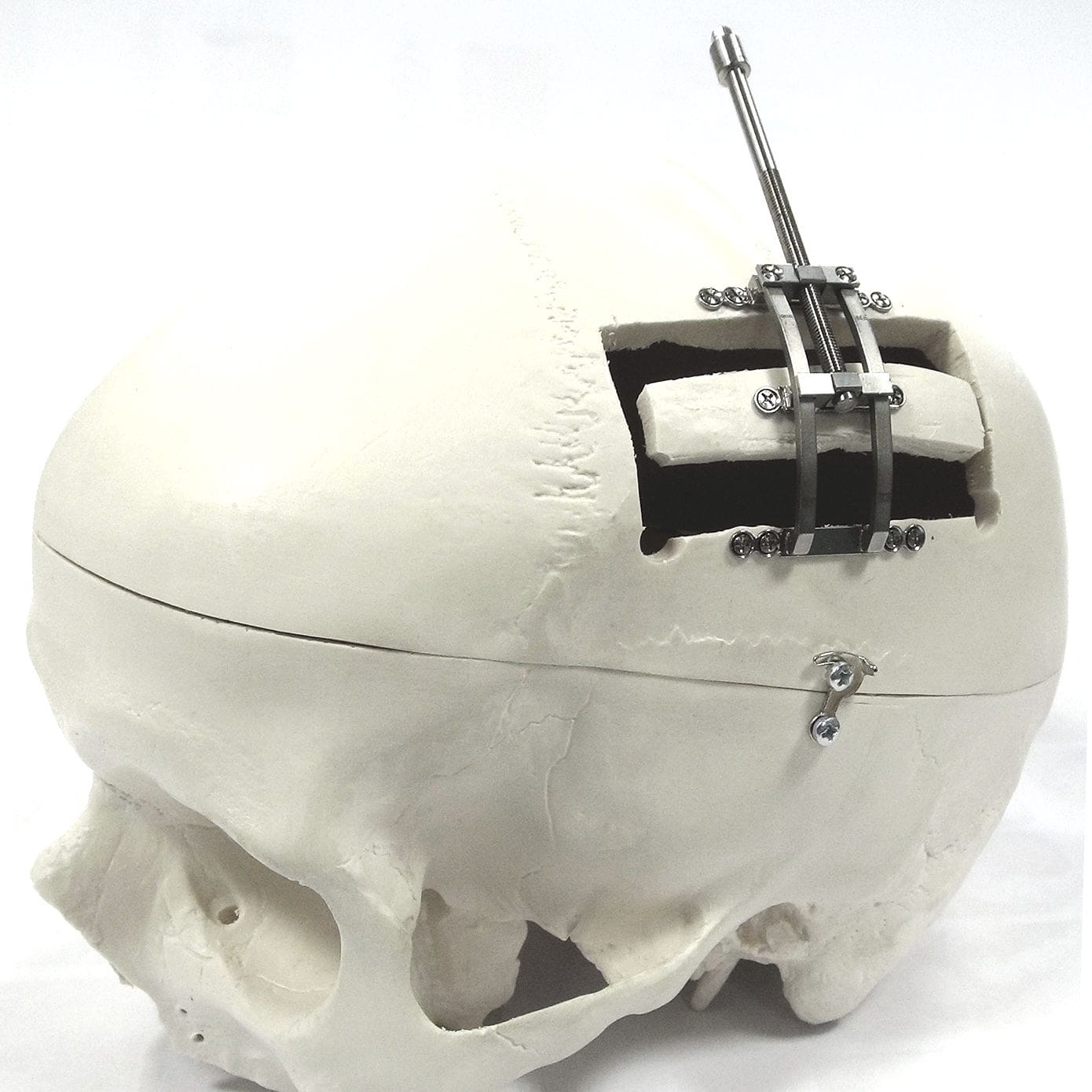 Cranial distractor / internal / pediatric - - Jeil Medical Corporation