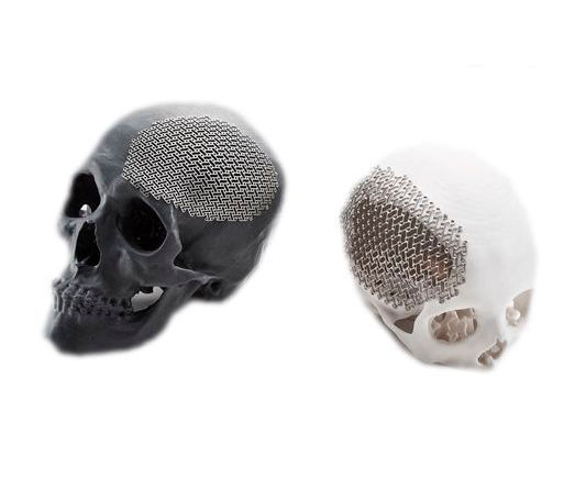 Custom-made cranial implant - JCI - Jeil Medical Corporation