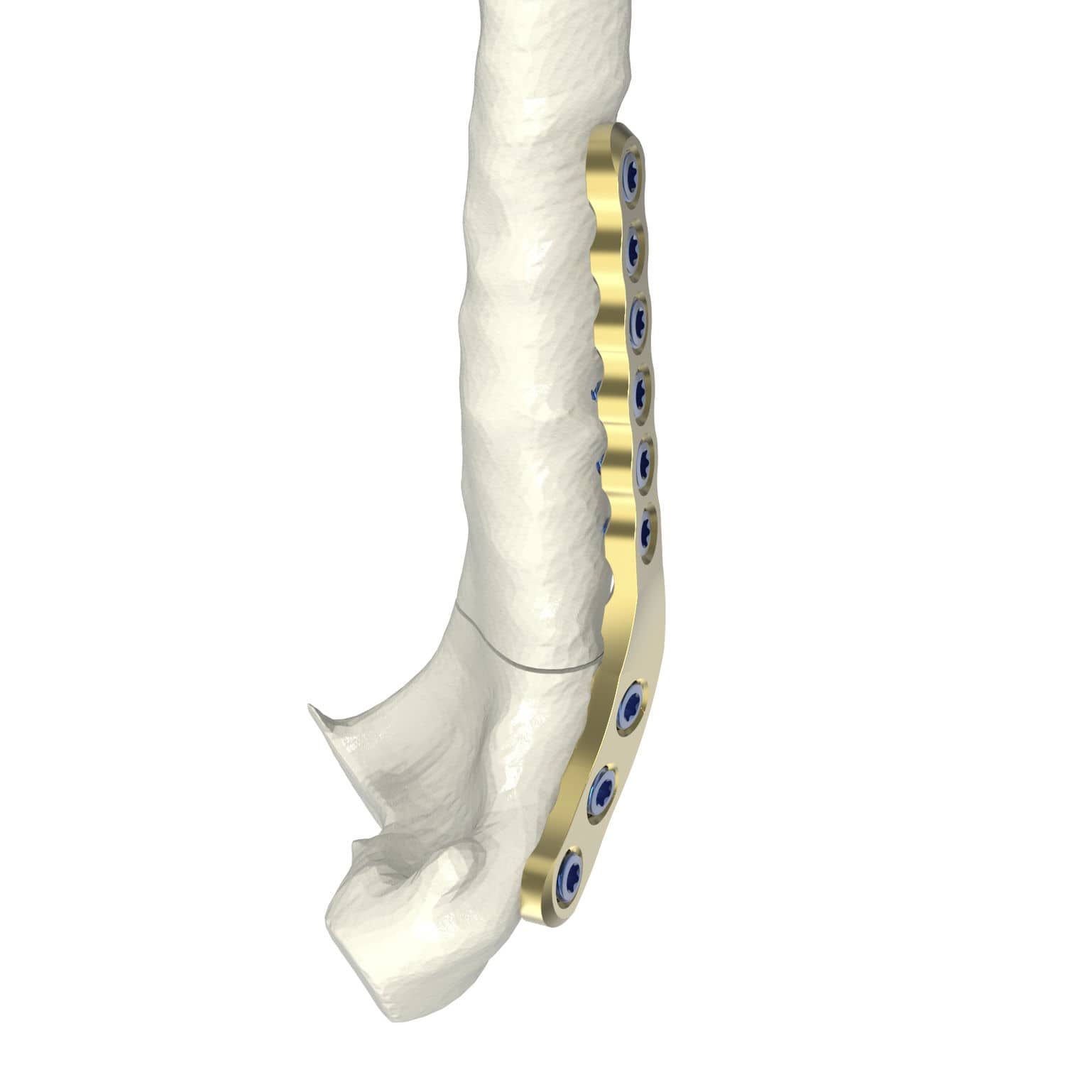 Veterinary osteotomy plate - ARIX VET - DFO - Jeil Medical Corporation