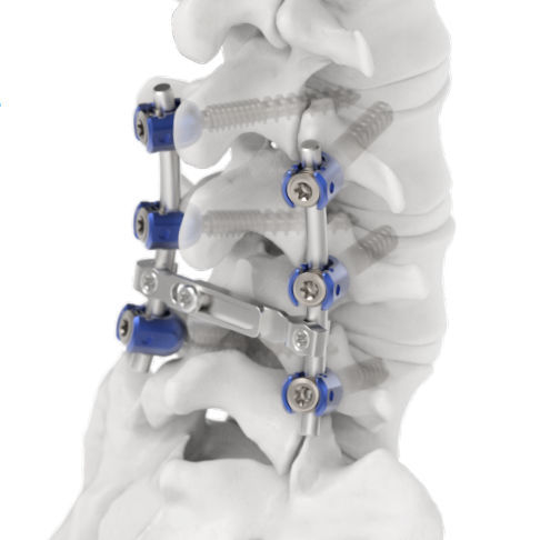 Lumbar osteosynthesis unit - Jeil Medical Corporation - posterior / adult