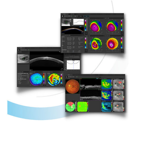 Analysis software - SOCT 11.5 - Optopol Technology - scan / eye ...