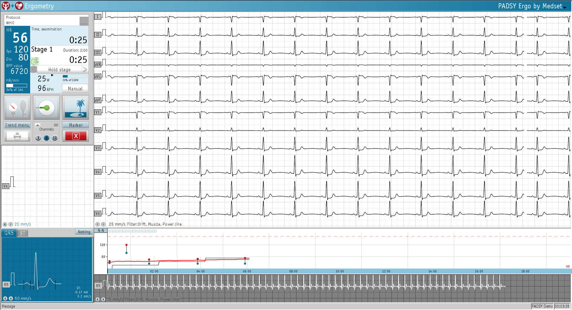 Analysis software - PADSY Ergo - Medset Medizintechnik - measurement / CPET