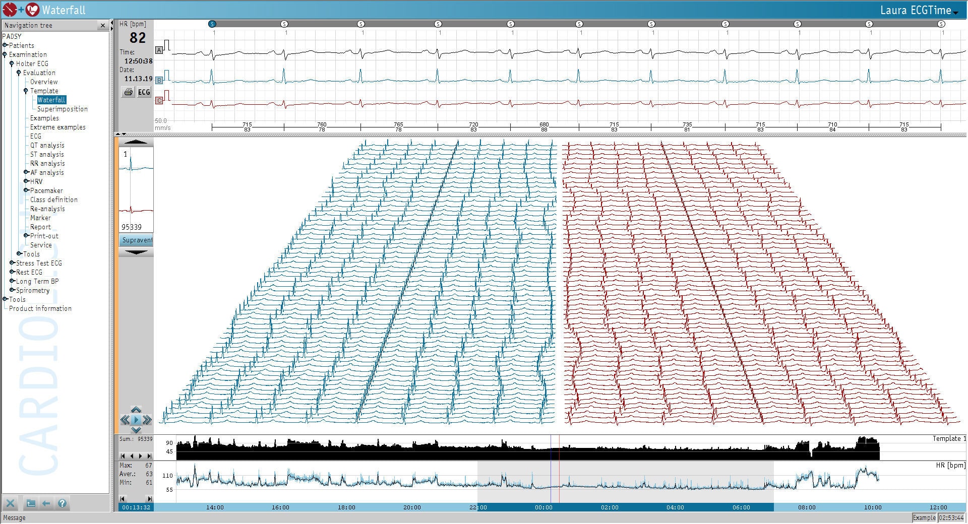 Cardiac Holter monitor software - PADSY Cardiolight - Medset ...