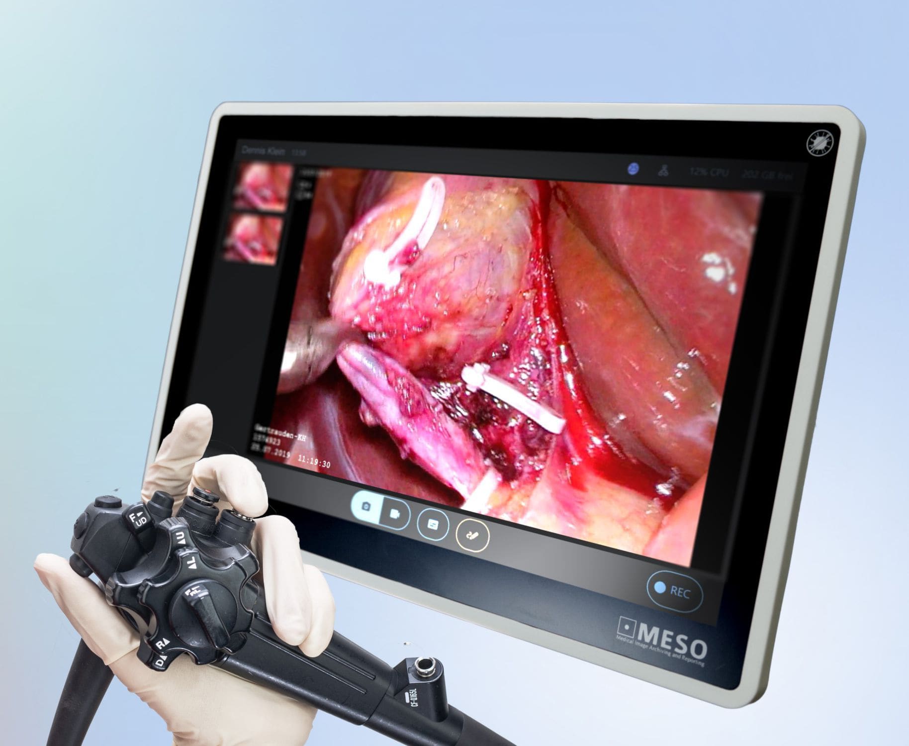 Video recorder with DICOM file conversion - IBox Touch - meso international GmbH - medical ...
