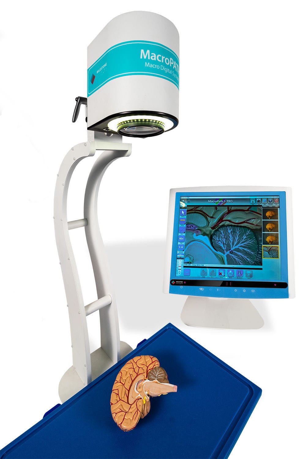 Research eye tracking device - LOOX - Milestone