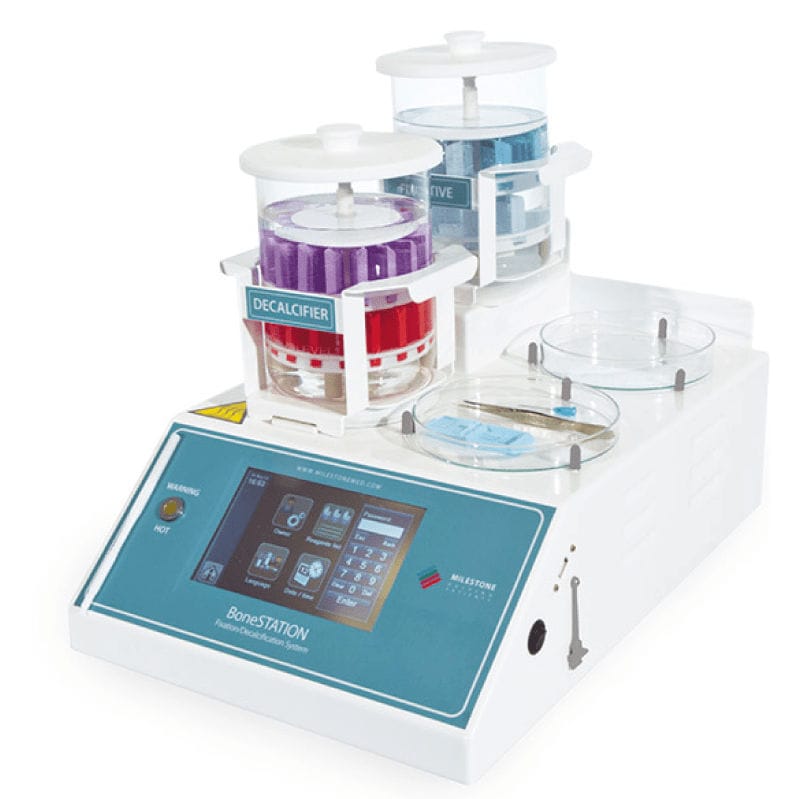 Fixing decalcification system - BoneSTATION - MILESTONE - bone tissue