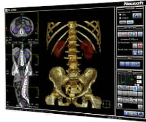 Visualization software - UroCARE - Neusoft Medical Systems - analysis ...