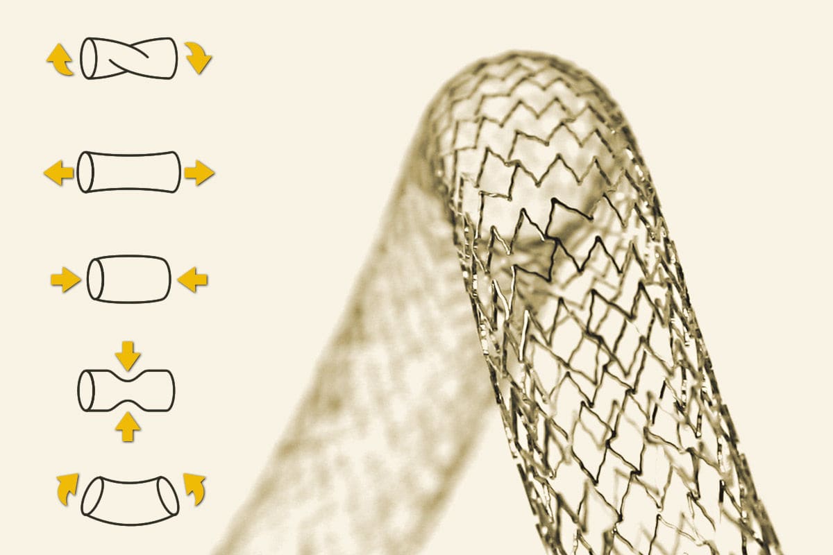 Peripheral stent / nitinol / self-expanding - SINUS-SUPERFLEX-635 ...