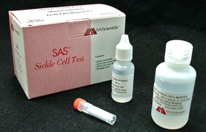 Rapid sickle-cell disease test - Sickle Cell - SA Scientific ...