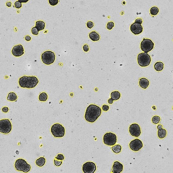 Analysis software module - Incucyte® Spheroid - Sartorius Group ...