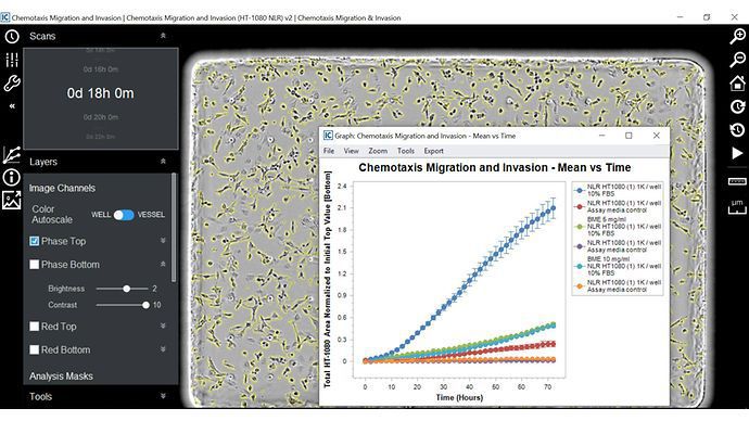 Image analysis software module - Incucyte® - Sartorius Group - capture / treatment / inspection