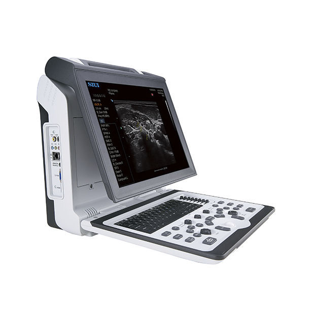 Portable ultrasound system - Apogee 2300 - SIUI - for urology ...