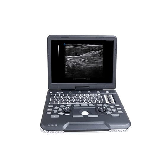 Portable ultrasound system - Apogee 1000 - SIUI - for multipurpose ...