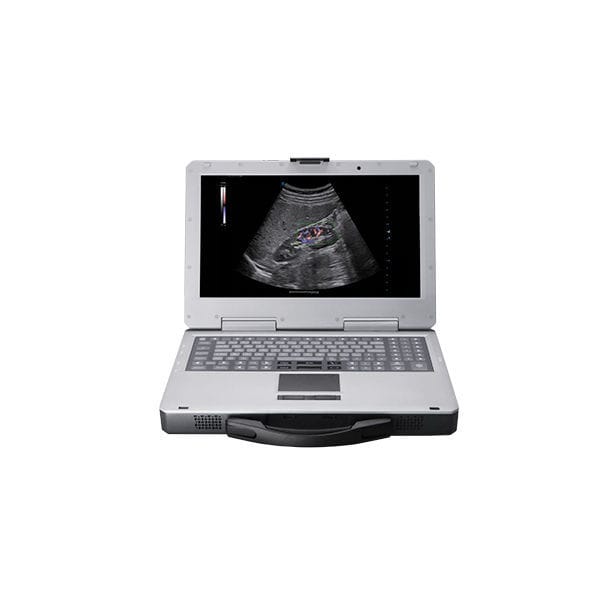 Portable ultrasound system - Apogee 1000 Plus - SIUI - for multipurpose ...