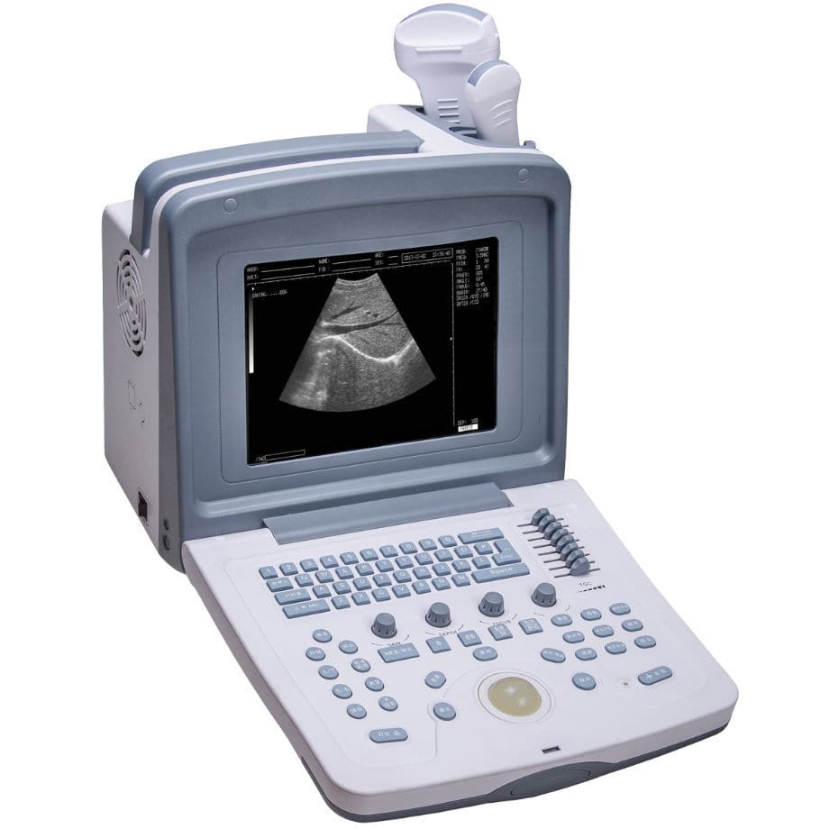Portable ultrasound system - WED-9618 - Shenzhen Well.D Medical ...